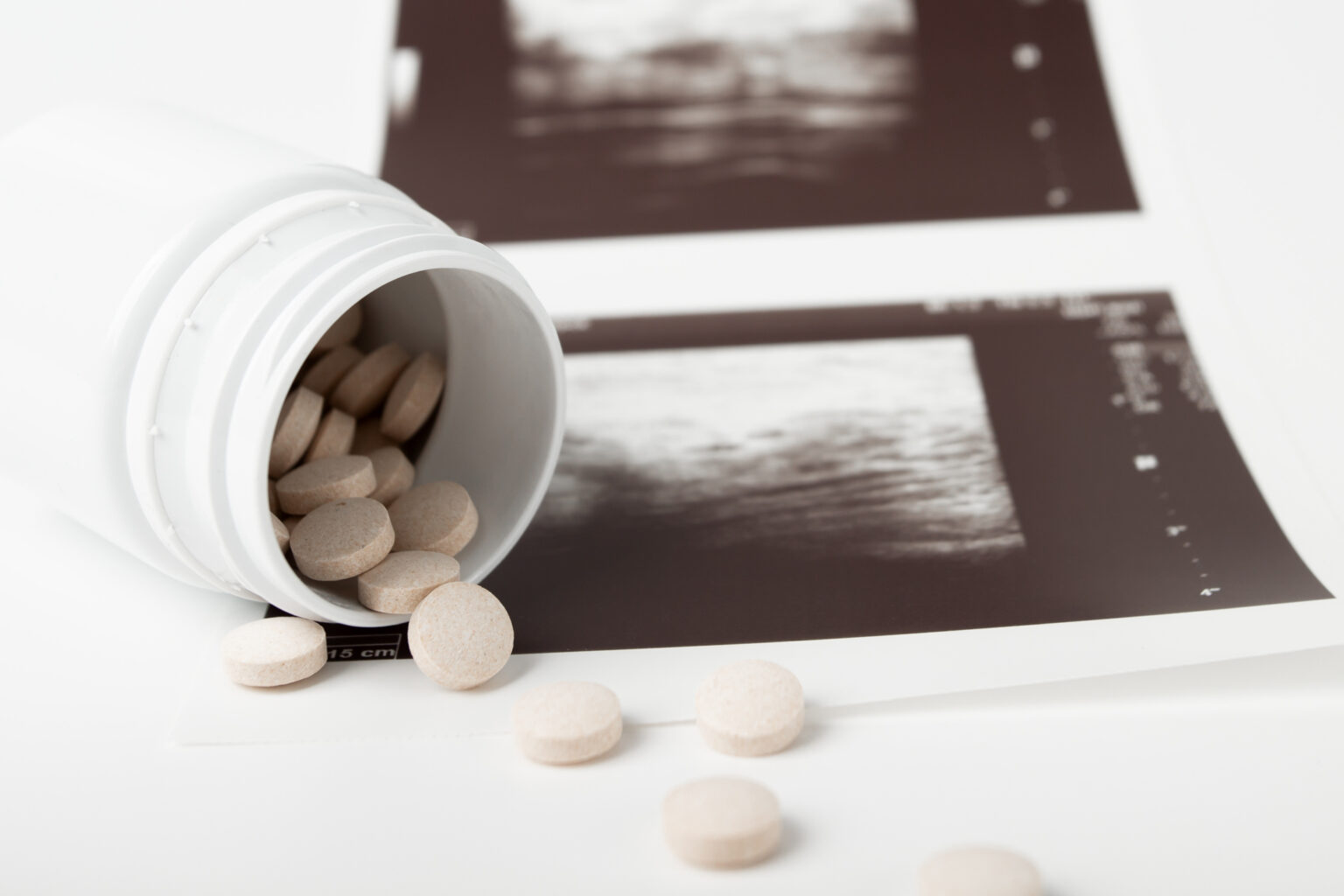 DKT International: The Global Network for Abortion Pills - Population ...